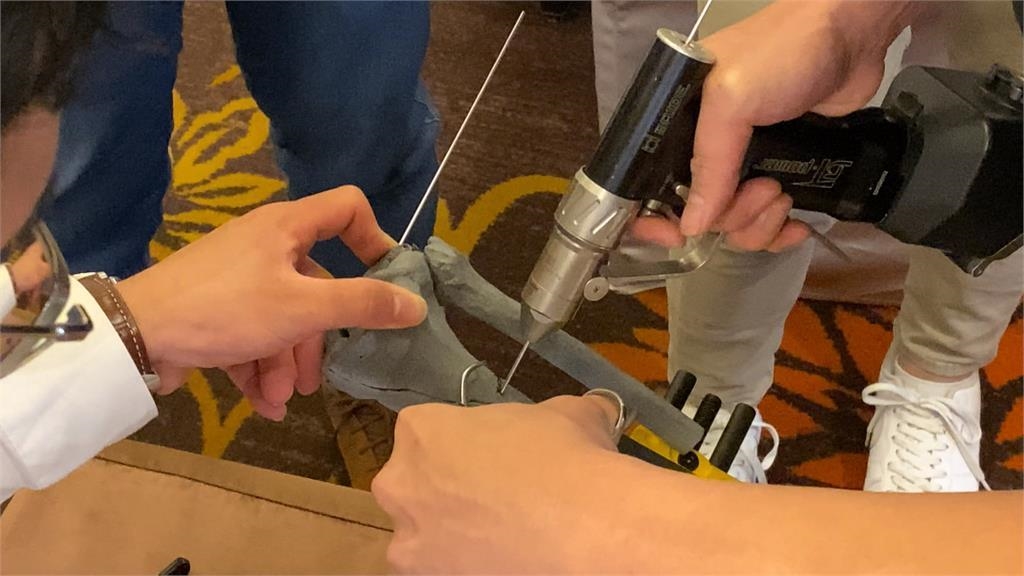 3D列印打造病人假骨 提供術前模擬降低風險｜四季線上4gTV