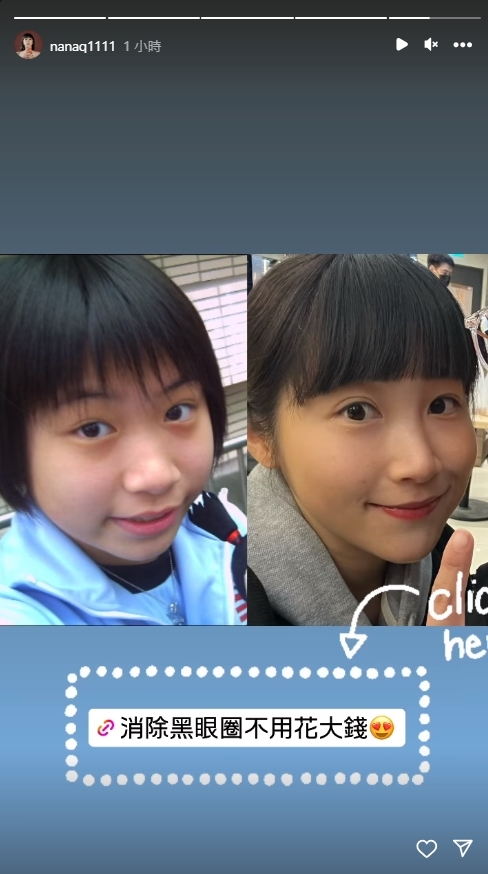 NanaQ驚人舊照「黑眼圈垮到顴骨」！+9造型判若兩人…嚇喊：台到瘋癲｜四季線上4gTV