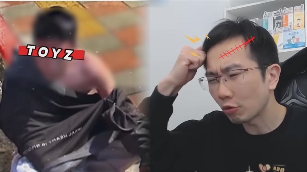 Toyz被打到腦震盪！蒼藍鴿指「72小時內需注意」：有這症狀就趕快就診｜四季線上4gTV