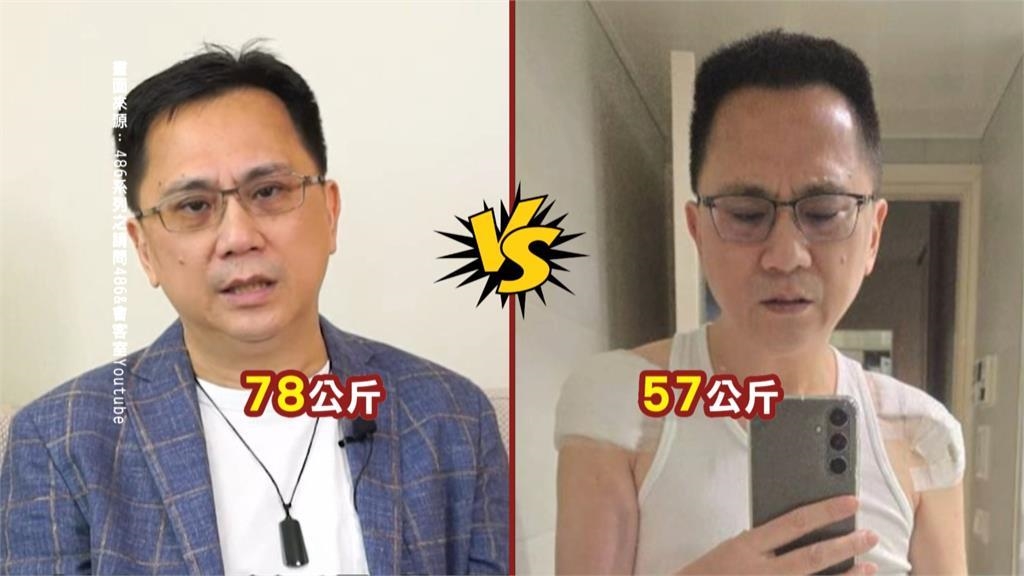 486先生健康亮紅燈 糖尿病+肩膀沾黏「爆瘦21公斤」｜四季線上4gTV
