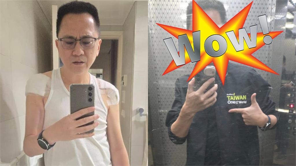 486先生緊急手術「突瘦3公斤」！他現身吐近況：還是有神經痛｜四季線上4gTV